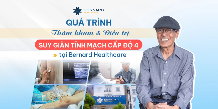 CHẤM DỨT 10 NĂM SUY GIÃN TĨNH MẠCH CHỈ VỚI 1 LẦN ĐIỀU TRỊ LASER, VIỆT KIỀU MỸ TIẾT KIỆM ĐƯỢC ...